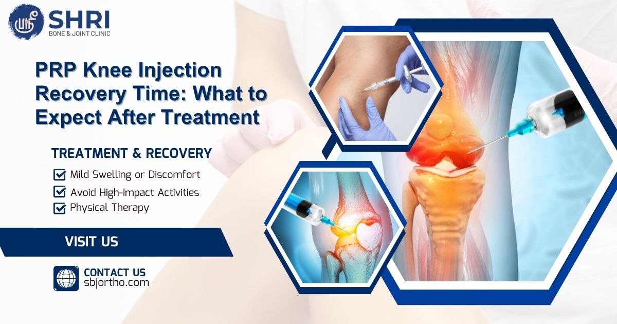 PRP Knee Injection Recovery Time What to Expect After Treatment- Shri Bone & Joint Clinic | Shri ...